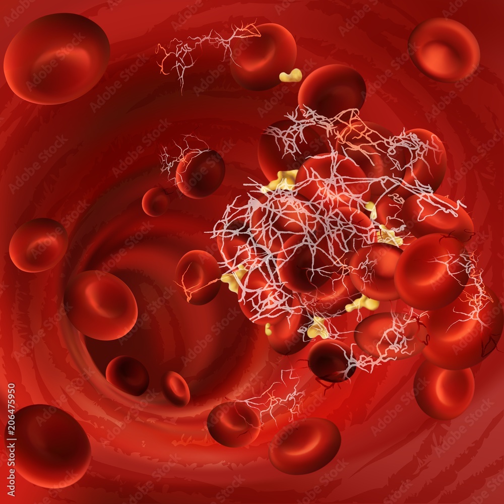 Blood clot Stock Vector | Adobe Stock