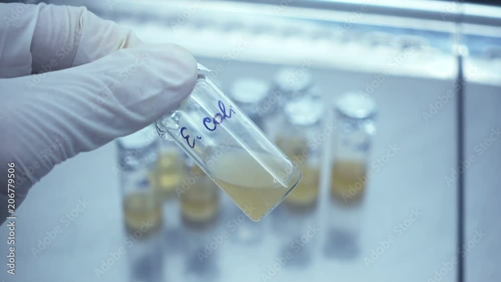 The scientist makes an analysis of the liquid culture of Escherichia ...