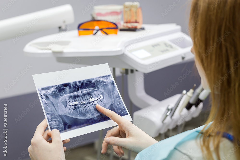 Dentist explaining the details of a x-ray teeth picture to his patient ...