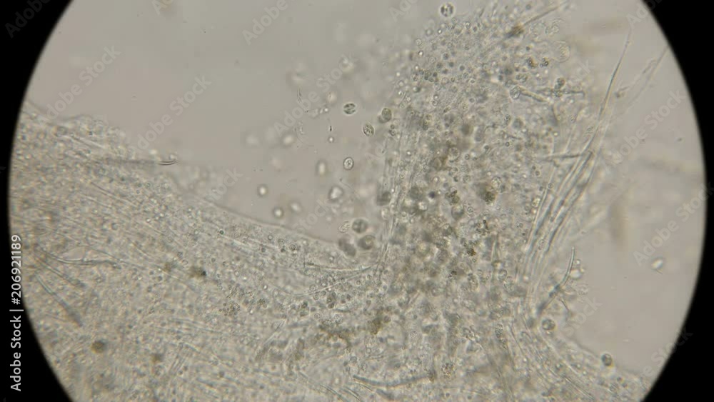 a colony of microorganisms that multiplies and consumes worm remains ...