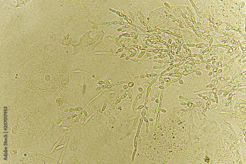 Urine Culture Yeast Treatment at Jai Patrick blog