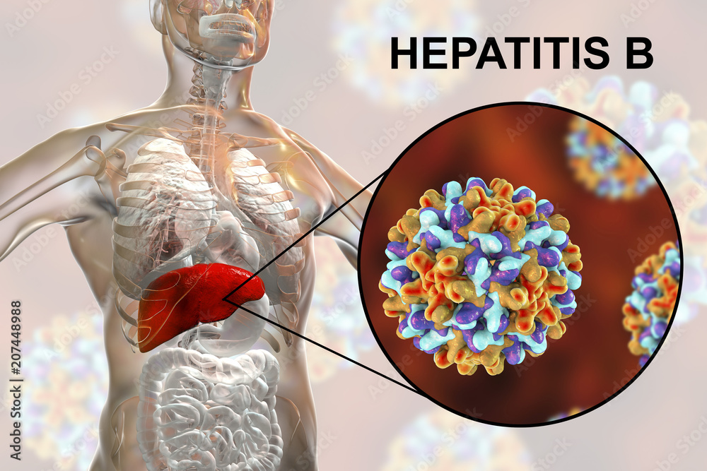 Liver with Hepatitis B infection highlighted inside human body and ...