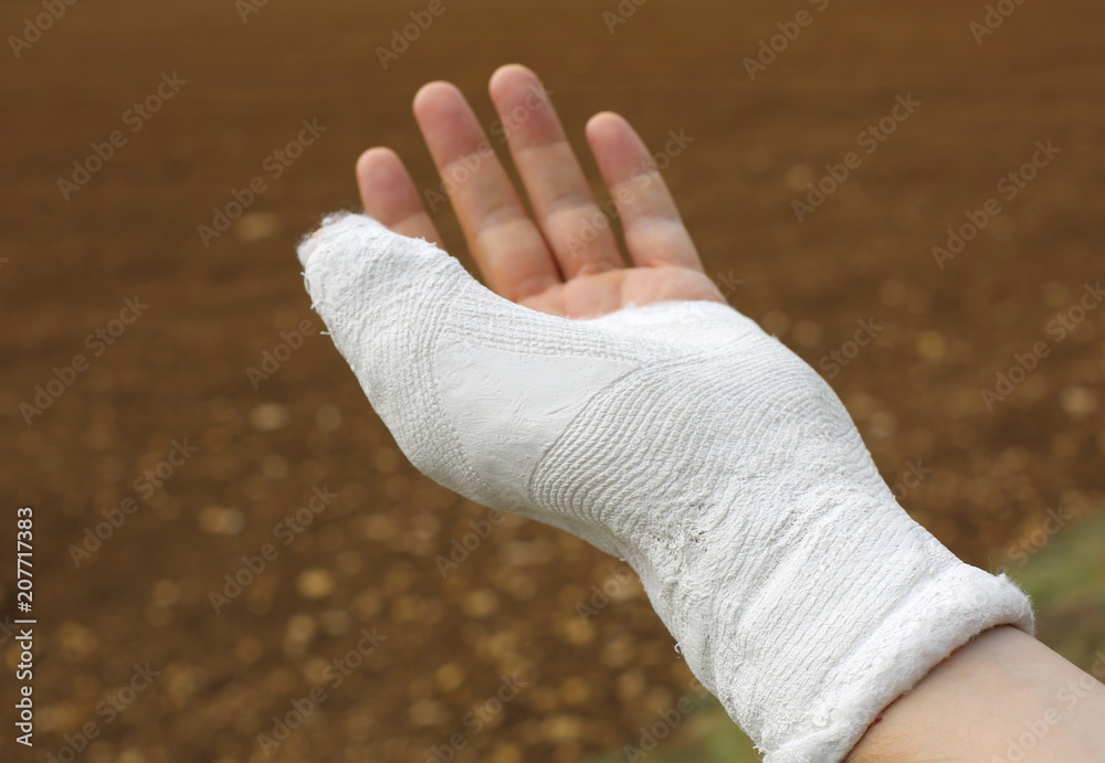 Plaster Hand Glove