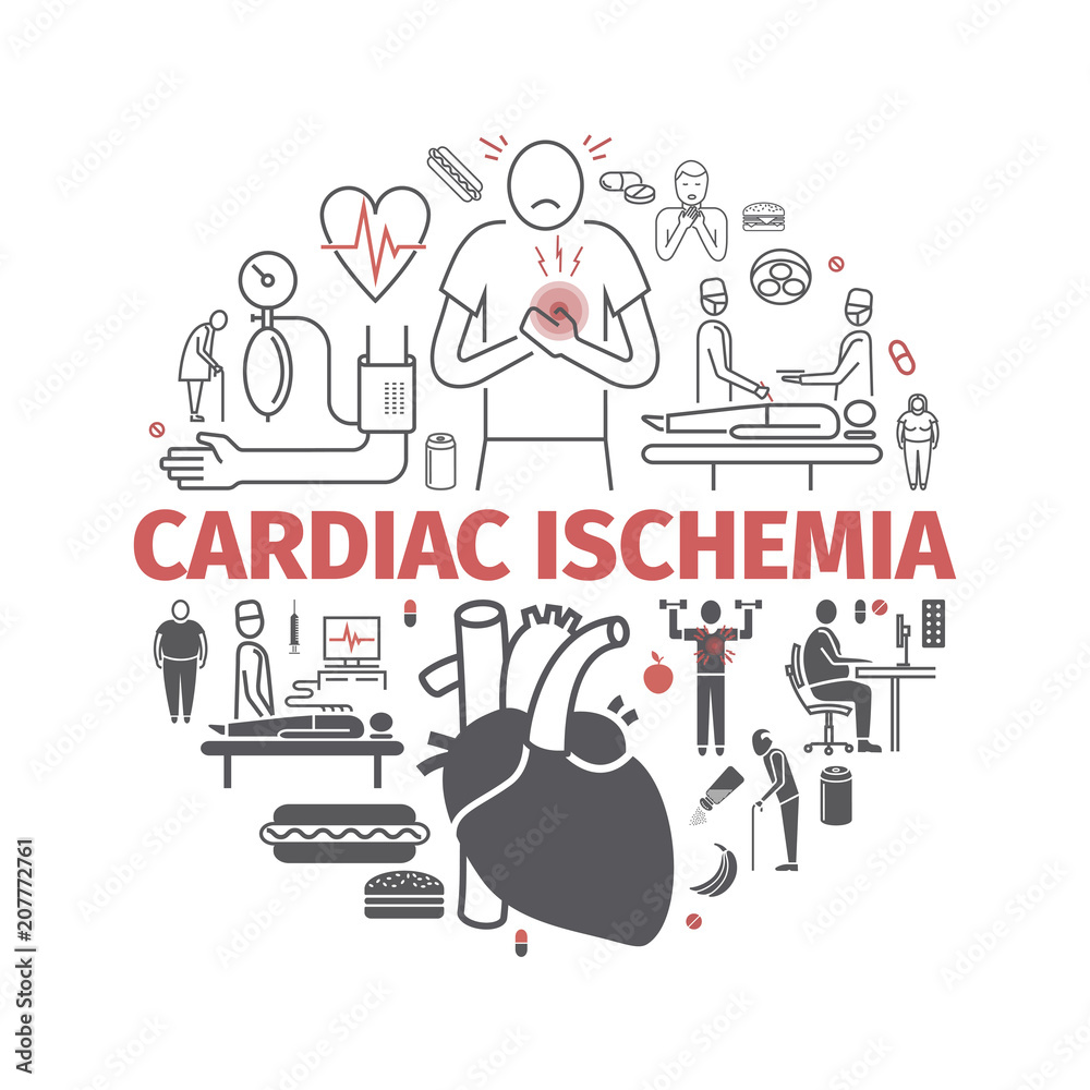 Cardiac ischemia banner. Symptoms, Treatment. Line icons set. Vector ...