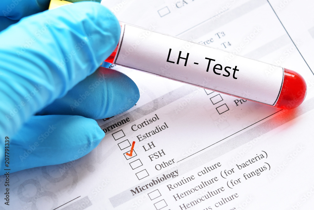 Blood sample tube with laboratory requisition form for luteinizing ...