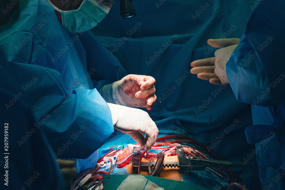 cardiovascular surgery team surgeons in surgery center for ...