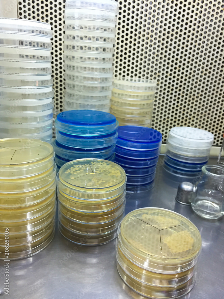 Blue agar CAS assay used for siderophore detection and white ...