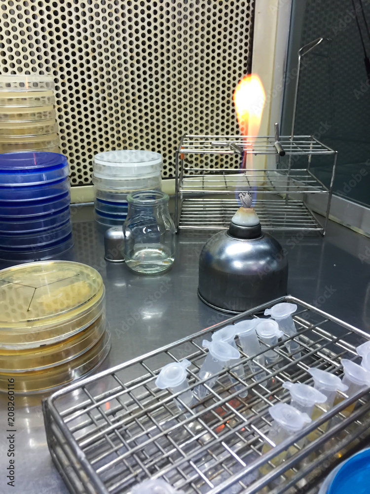 Blue agar CAS assay used for siderophore detection and white ...