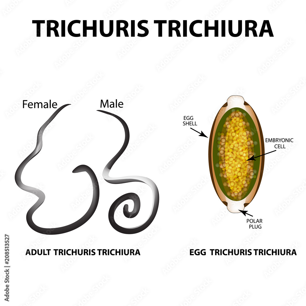Trichuris Trichiura