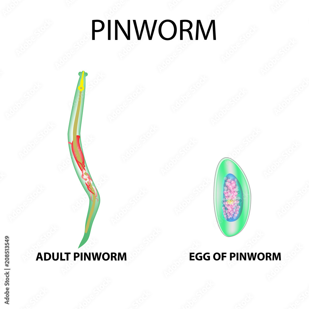 Pinworms structure of an adult. The structure of the pinworm egg. Set ...
