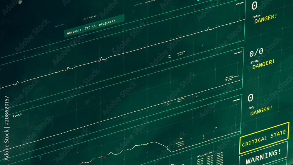 Patient dying, futuristic ICU monitor with dropping vital signs ...