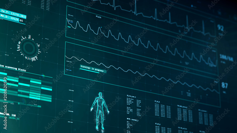 Foto Stock Intensive care unit monitor showing patient's vital signs ...