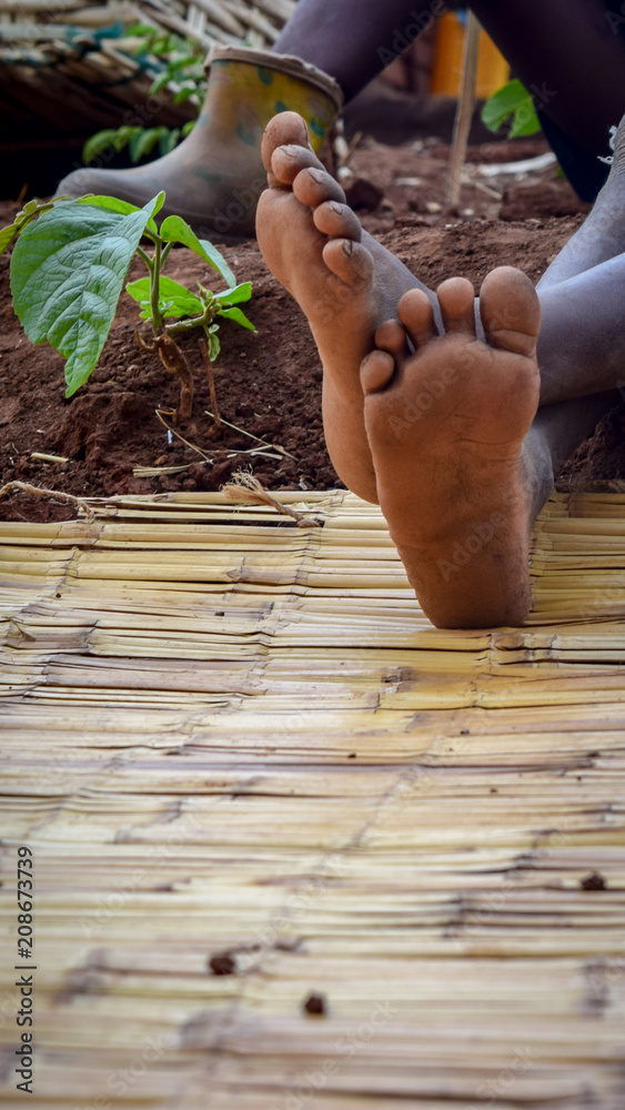 Poor young villager barefoot in Malawi, Africa Stock Photo | Adobe Stock