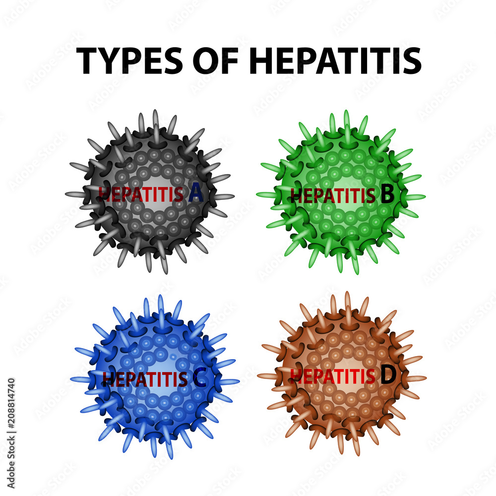 Types of Hepatitis. Viruses Hepatitis A, B, C, D. Infographics. Vector ...