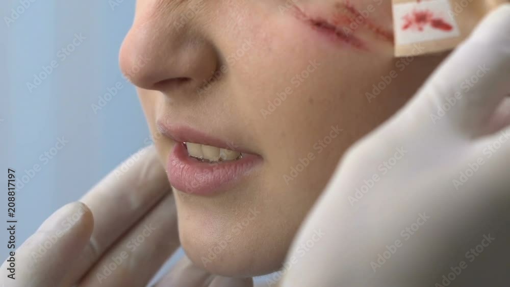 Nurse taking plaster off from patient face, scar prevention, wound ...