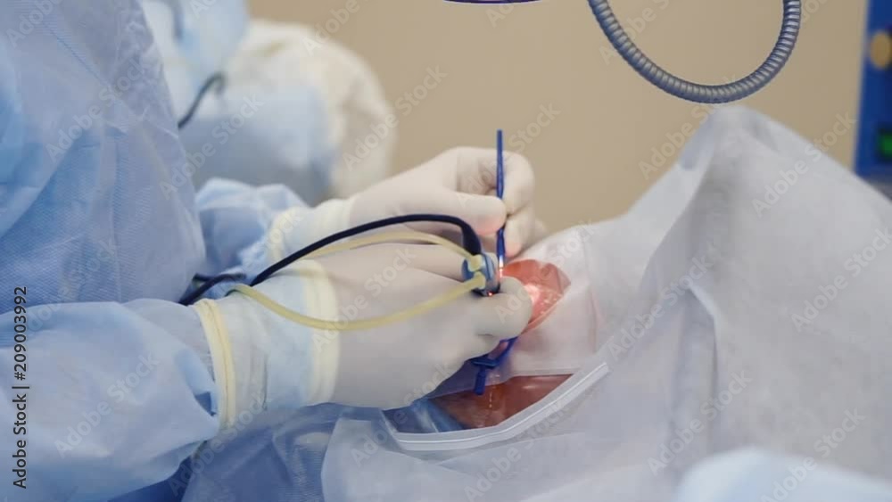 close up shot of an analmologist's hands, the eye doctor holds ...