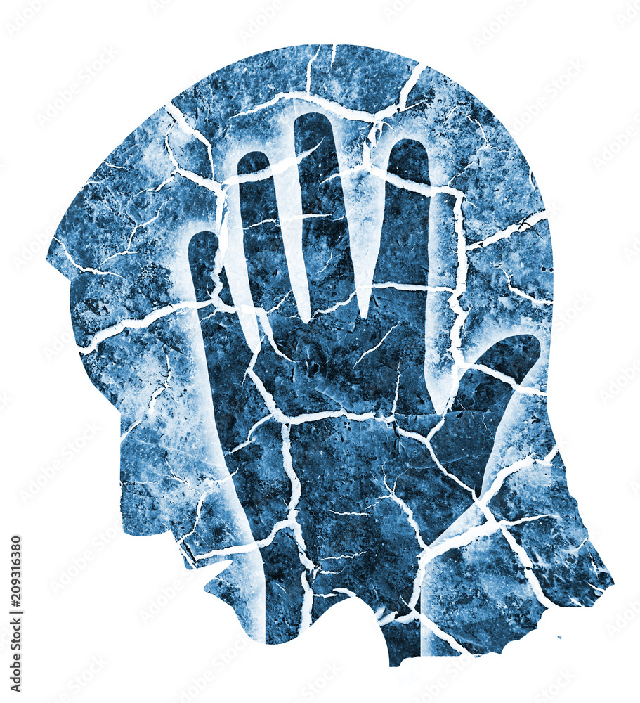 Depression Headache, male head. The man held his head with cracked ...