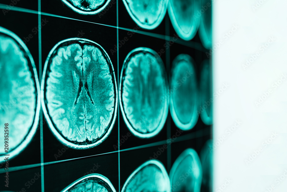 X-ray of the head and brain, MRI, in defocus Stock Photo | Adobe Stock