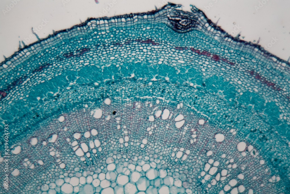 Stem cells of a lentil plant under the microscope. Stock Photo | Adobe ...