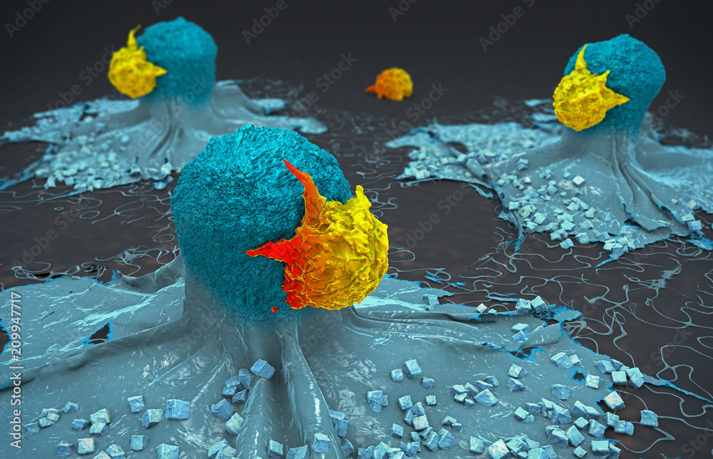 3d illustration of a cancer cell attacked and killed by lymphocytes ...