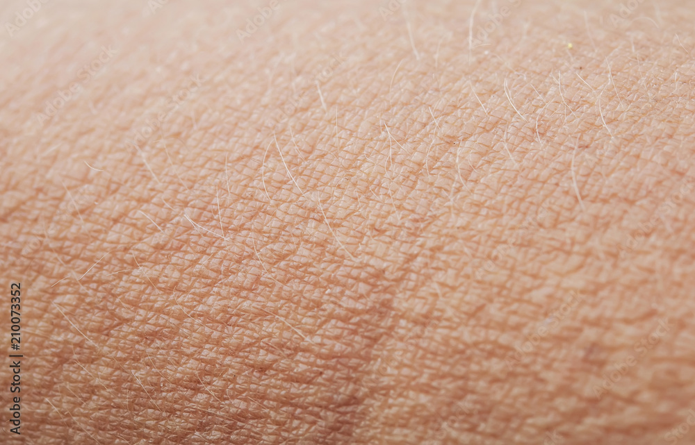 human skin covered with small goosebumps and hairs from the cold and ...