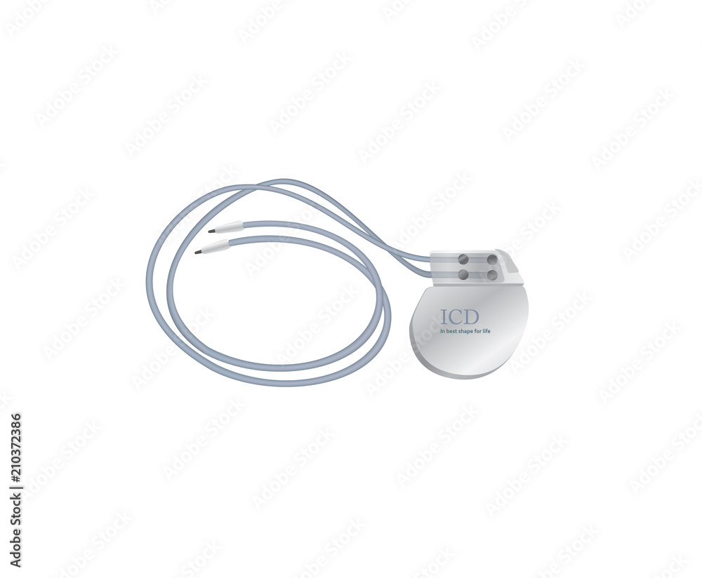 Heart pacemaker. Medical device. Human heart implantable cardiov Stock ...