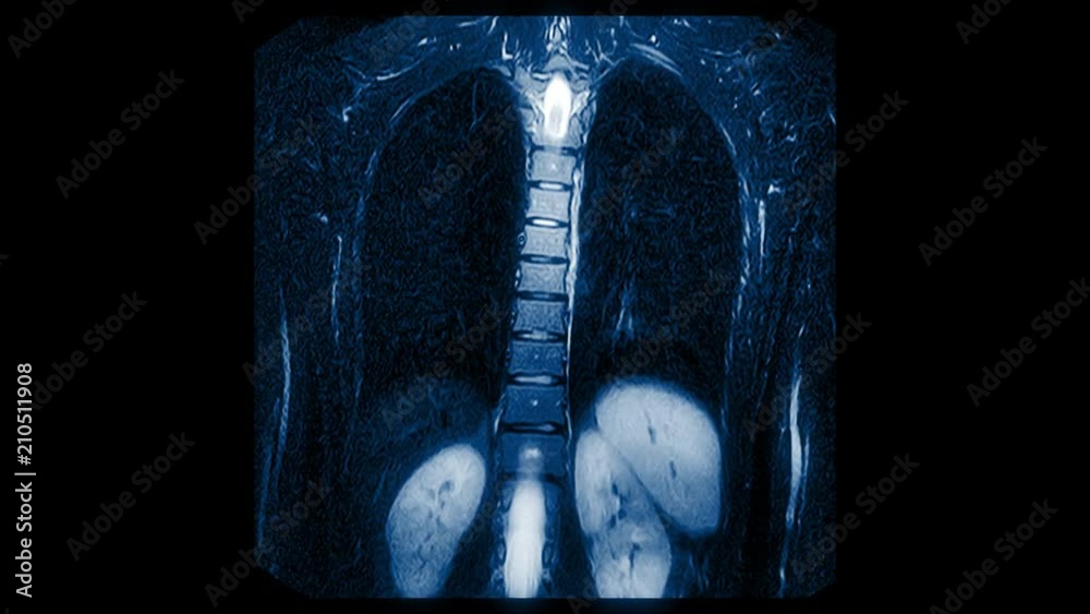 Computed medical tomography MRI upscaled scan of healthy young female ...