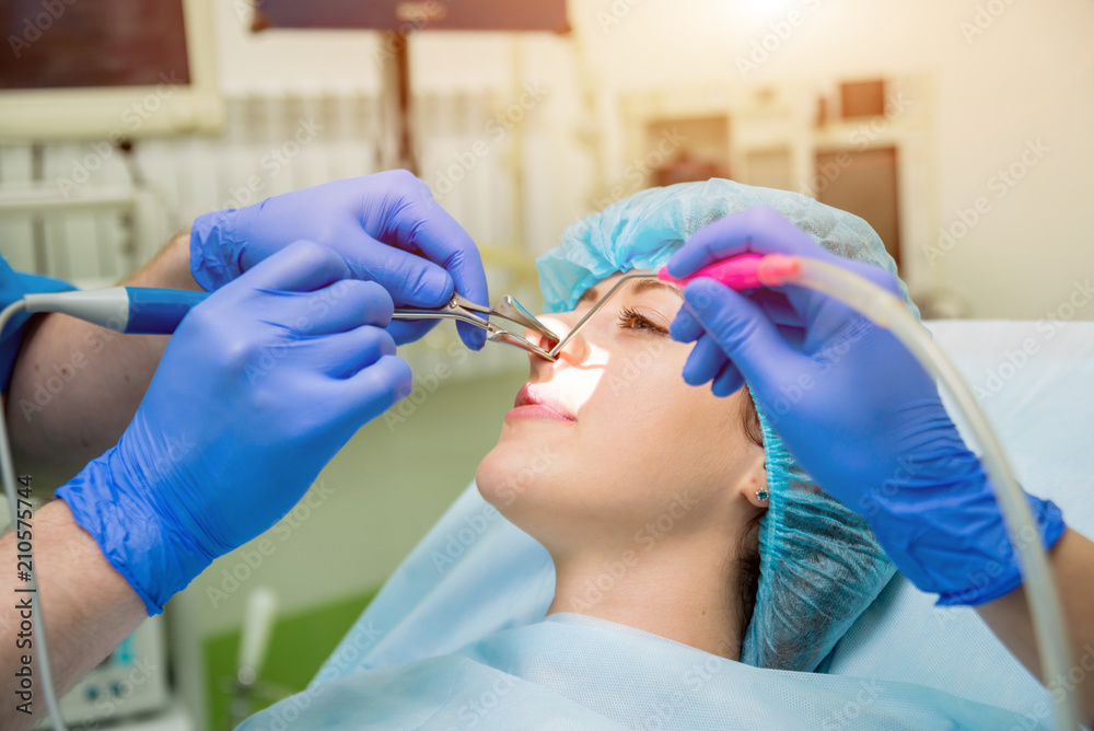 Laser vaporization of nasal concha with coblation technology method ...