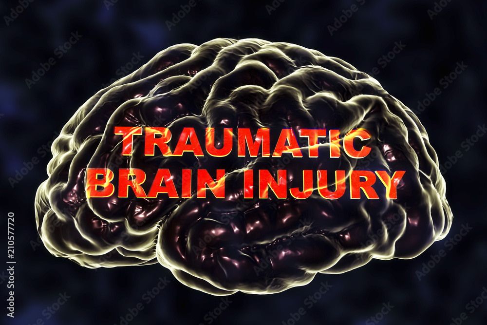 Traumatic injury of human brain, 3D illustration. Conceptual image ...