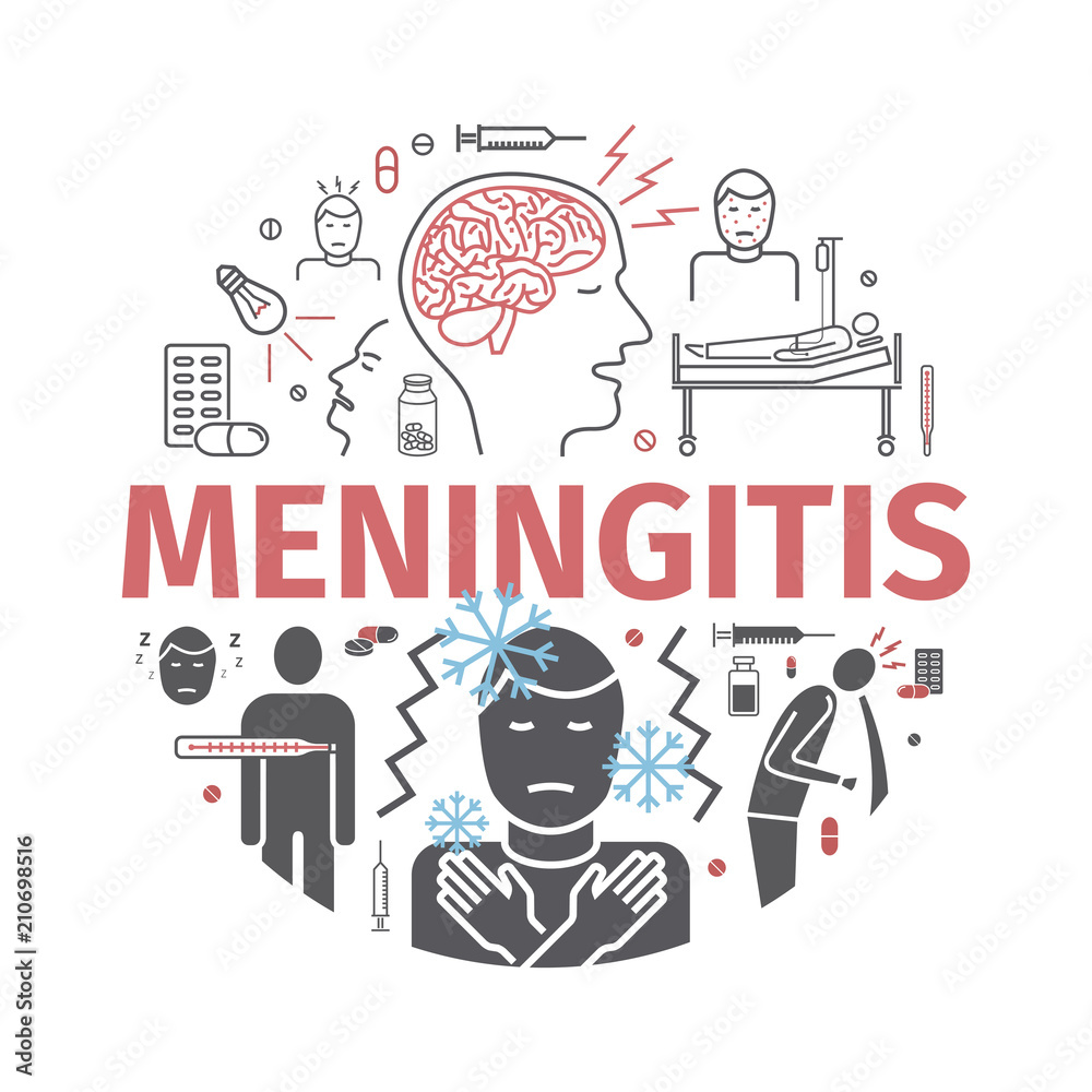 Meningitis banner, web infographic. Vector illustration. Stock Vector ...