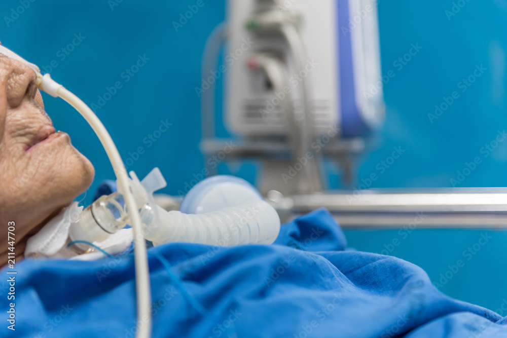 Patient do tracheostomy and ventilator in hospital Stock Photo | Adobe ...
