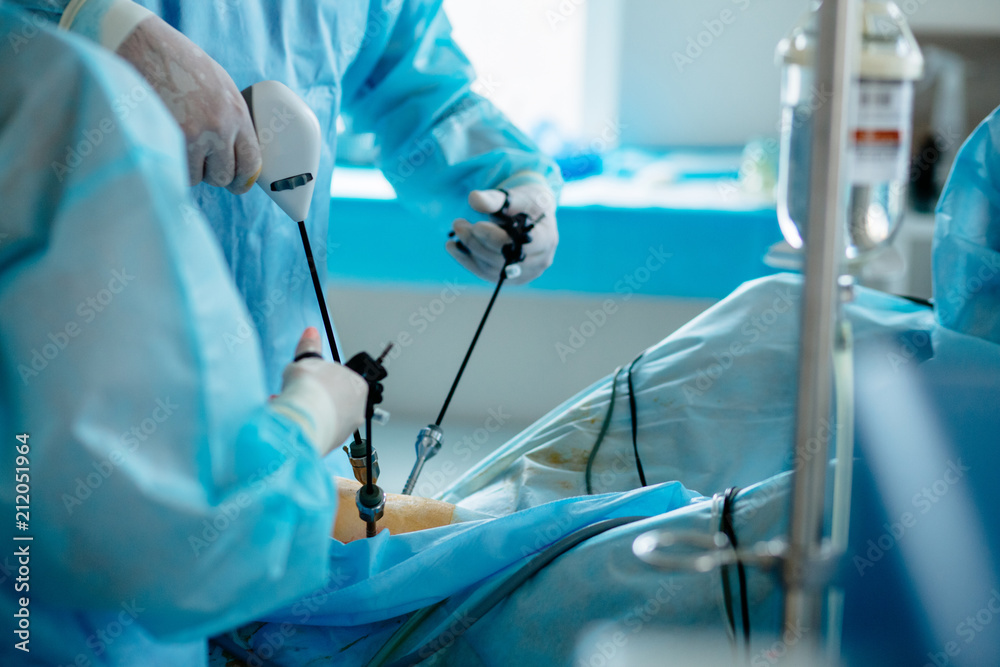 Unrecognizable surgeon's holing the instrument in abdomen of patient ...