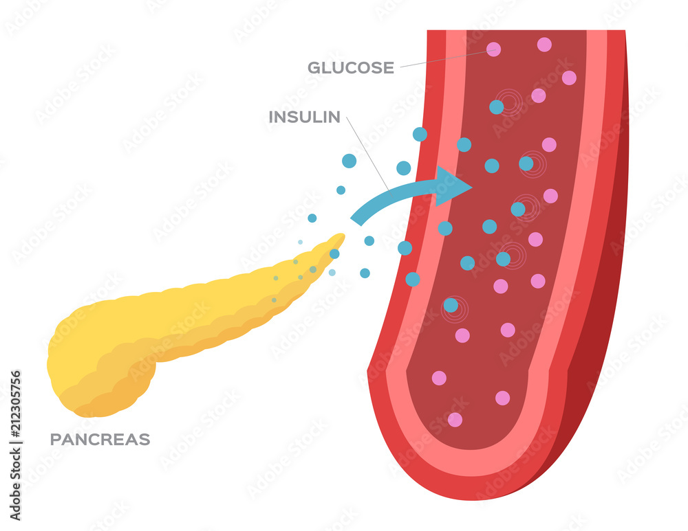 pancreas and insulin in blood vector Stock Vector | Adobe Stock