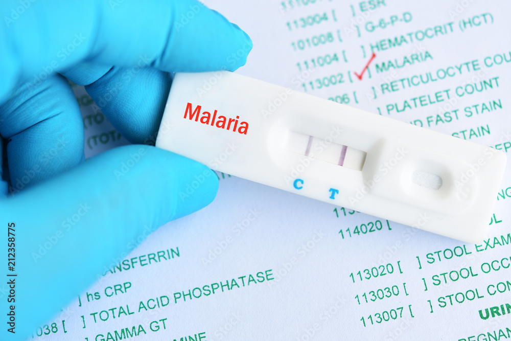 Foto de Malaria positive test result by using rapid test cassette do ...