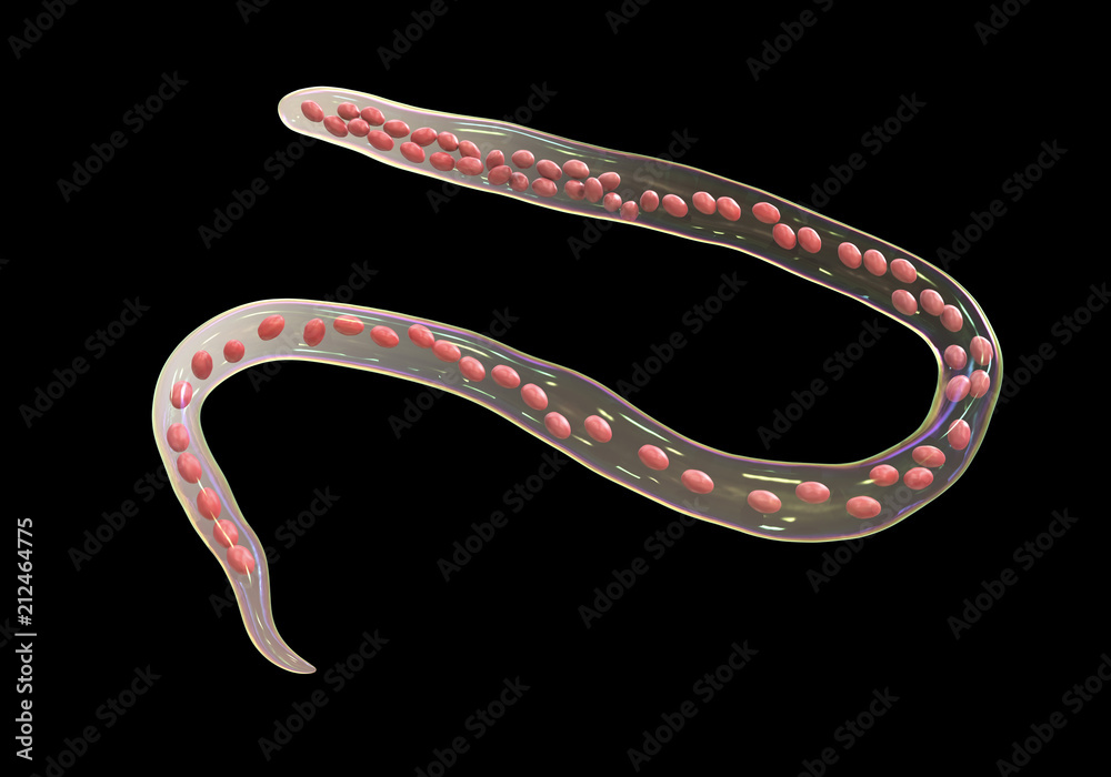 Mansonella ozzardi, a roundworm nematoda that causes serous cavity ...