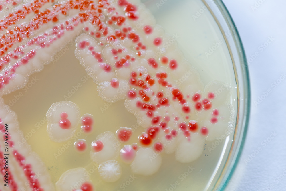 What Causes Serratia Marcescens Bacteria at Molly Lowes blog