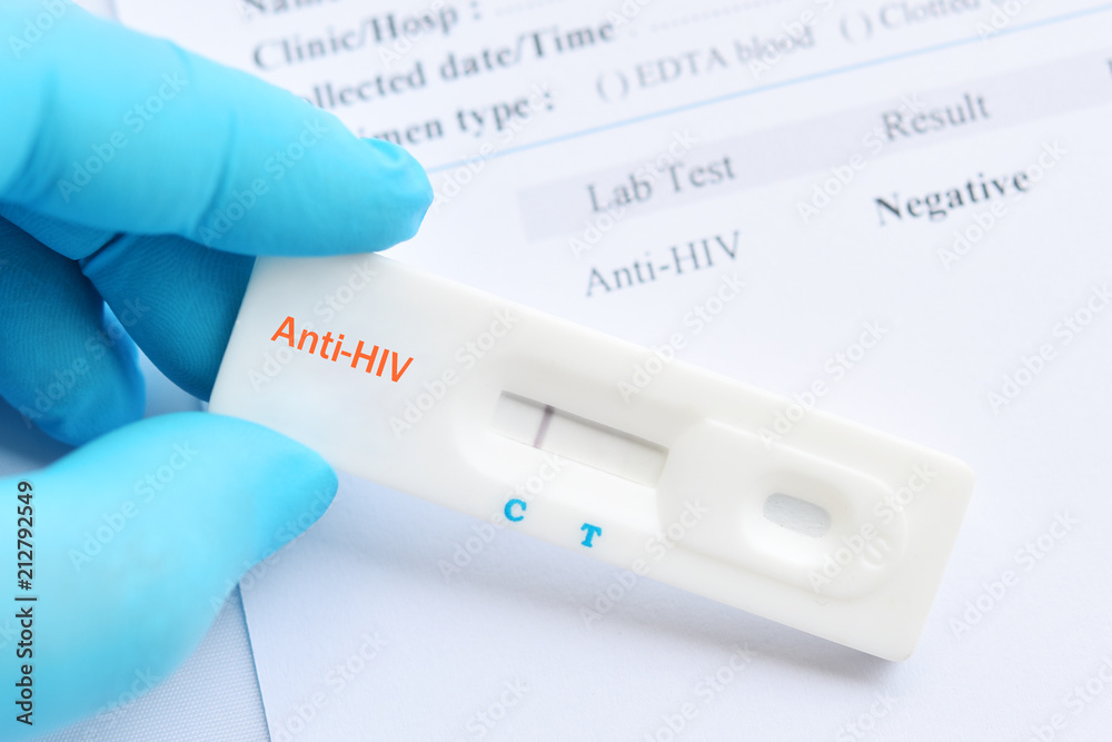 HIV Negative Test Result By Using Rapid Test Cassette Stock Photo