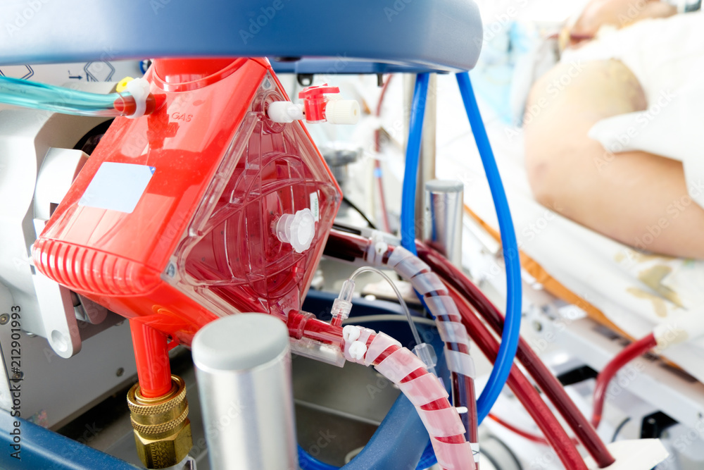 working ecmo machine in intensive care department Stock Photo | Adobe Stock