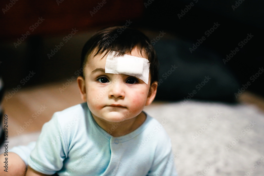 Little baby with little wound on his forehead Stock Photo | Adobe Stock
