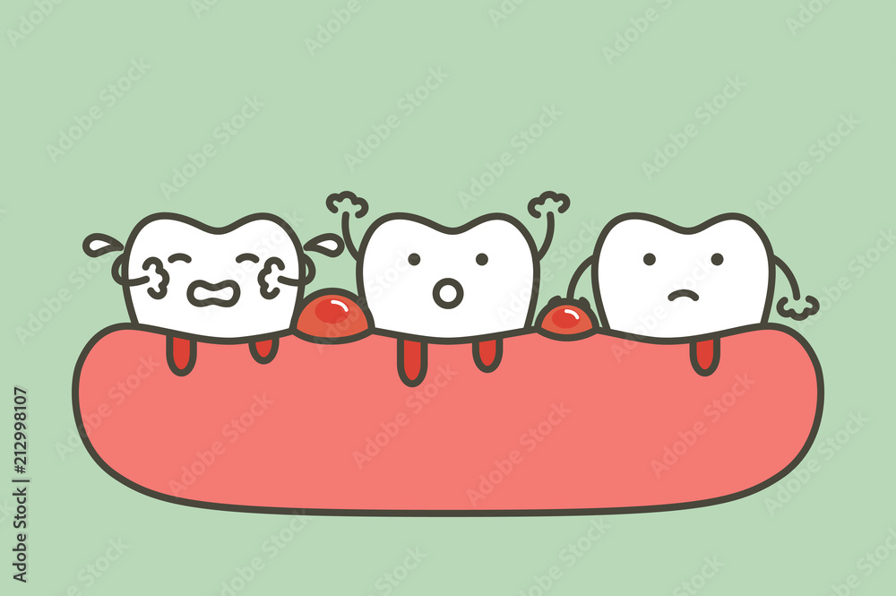 periodontitis or gum disease with bleeding - teeth cartoon vector flat ...