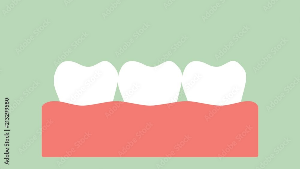 dental crown, installation process and change of teeth - dental cartoon ...
