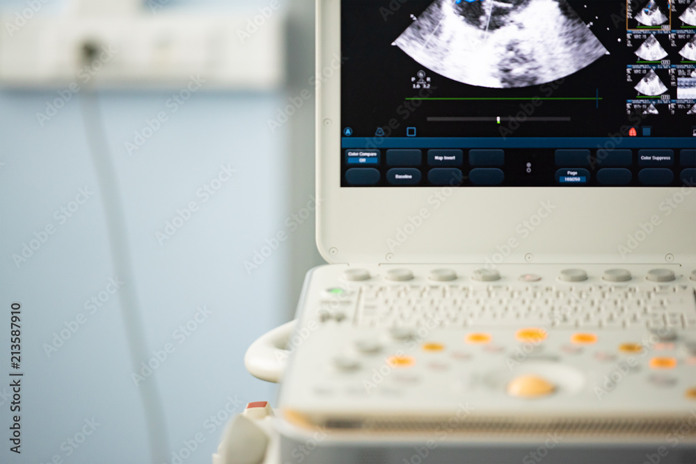 Image of a modern ultrasonic scanner with a keyboard and a monitor ...