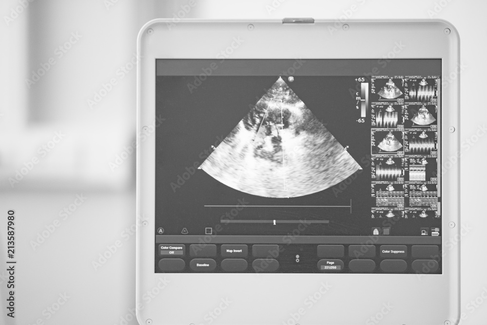 The monitor of the modern ultrasonic scanner with the image of blood ...