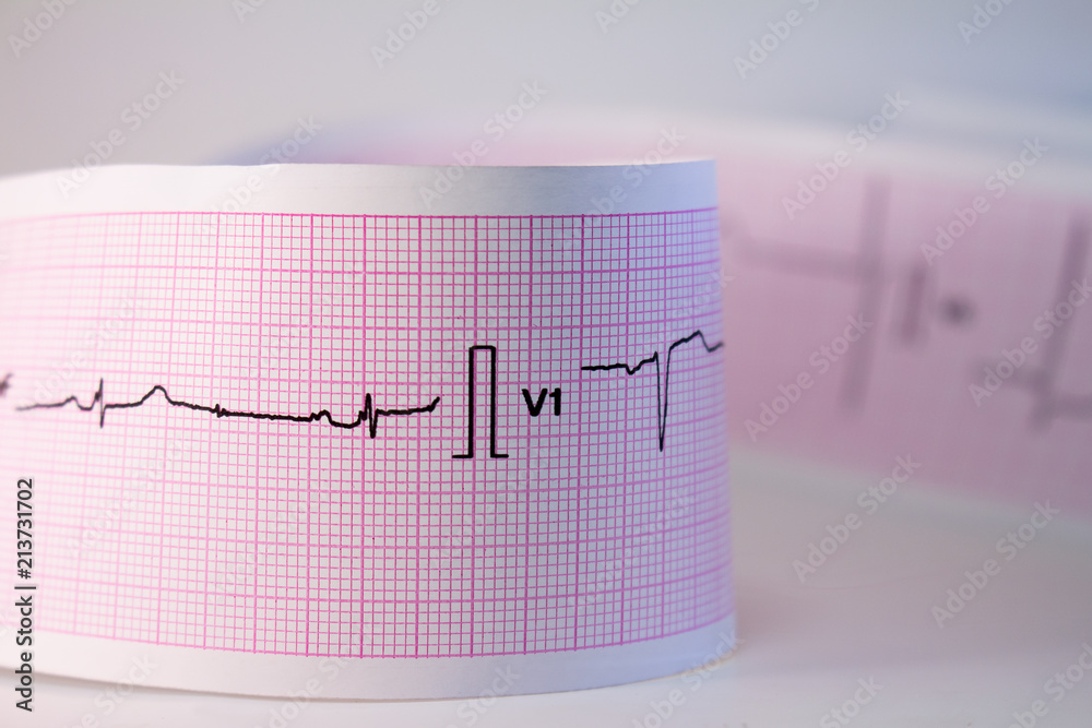 Approach of an electrocardiogram strip. Record of the electrical ...