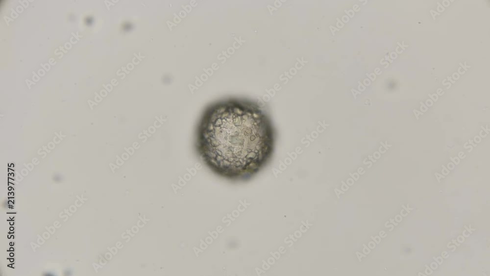 shell of Testacea amoeba Difflugia class lobostoma top view of the ...