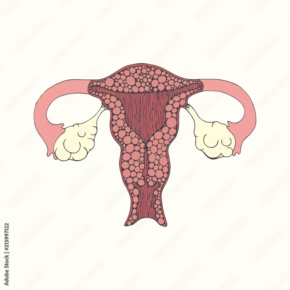 Uterus. Female body. Vector illustration Stock Vector | Adobe Stock