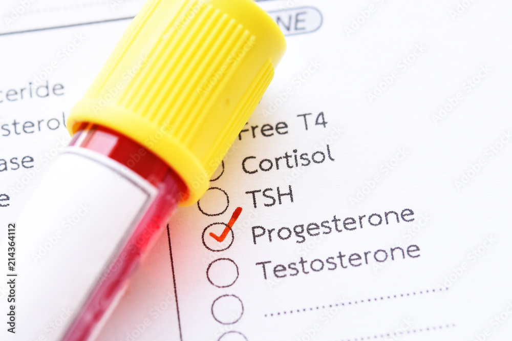 Blood sample tube with laboratory requisition form for progesterone ...