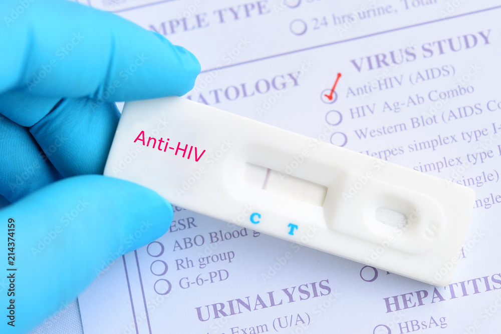 HIV negative test result by using rapid test cassette Stock Photo ...
