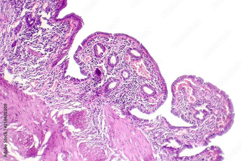 Microscopic Gallbladder