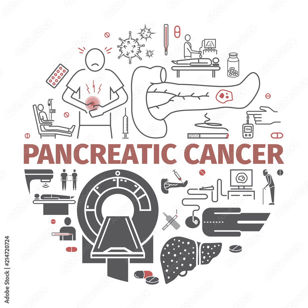 Pancreatic Pancreas Cancer Symptoms. Causes. Vector signs. Stock Vector ...